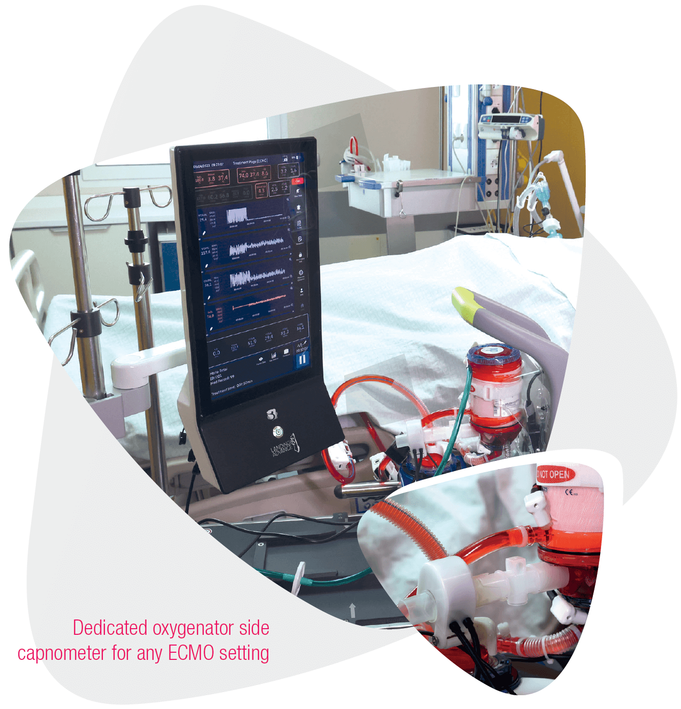 Landing Advance ECLS – Eurosets
